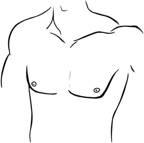 Veste compresive pentru operaţia de ginecomastie